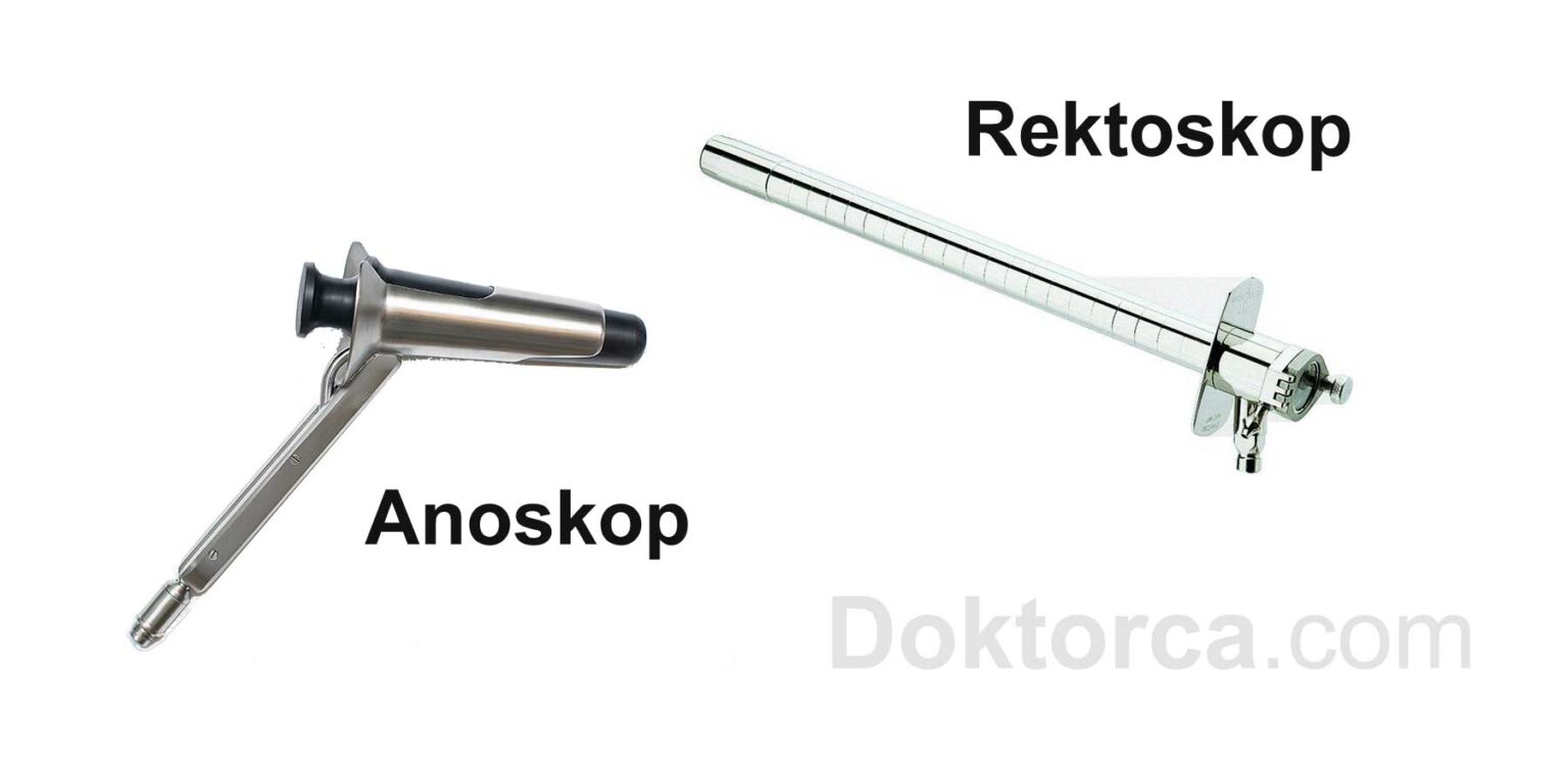 Rektoskopi ve anoskopi nedir ve nasıl yapılır? • Doktorca